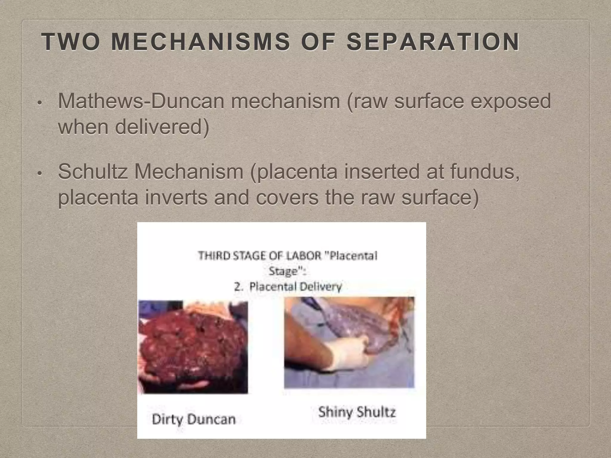 Normal labour and delivery ppt | PPTX