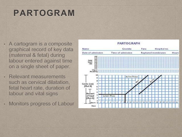 Normal labour and delivery ppt | PPTX | Pregnancy | Reproductive Health