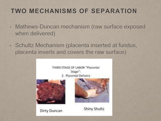 Normal labour and delivery ppt | PPT