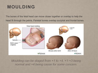 Normal labour and delivery ppt | PPT