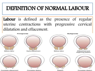 Normal labour and physiology of normal labour | PPTX