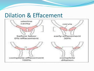 Normal labour [autosaved] | PPT