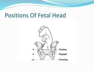 Normal labour [autosaved] | PPT