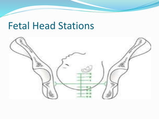 Normal labour [autosaved] | PPT