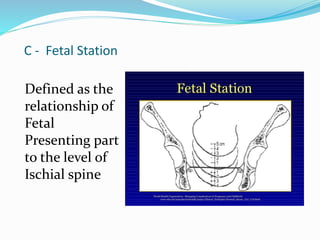 Normal labour [autosaved] | PPT