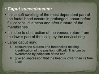 Normal labour by syed hassnain shah | PPT