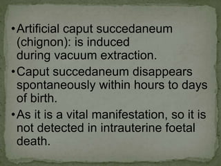 Normal labour by syed hassnain shah | PPT