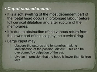 Normal labour by syed hassnain shah | PPTX