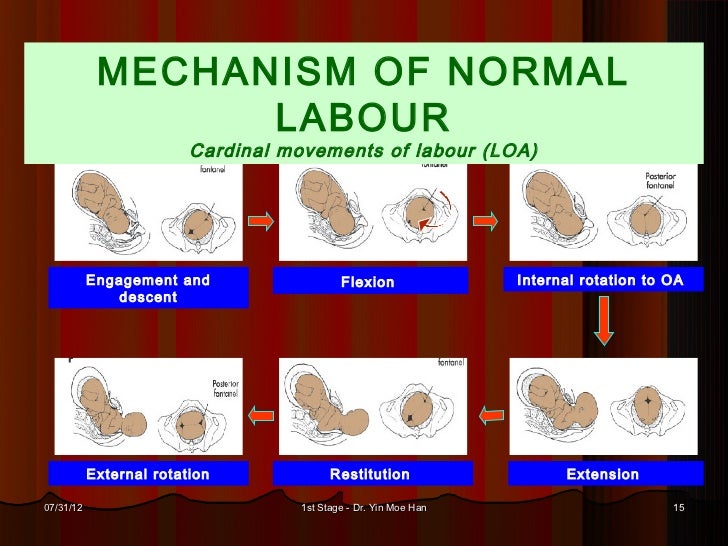 Normal labour, first stage by Yin Moe