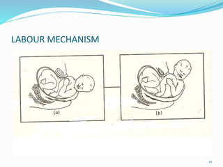 Normal labour intro | PPTX