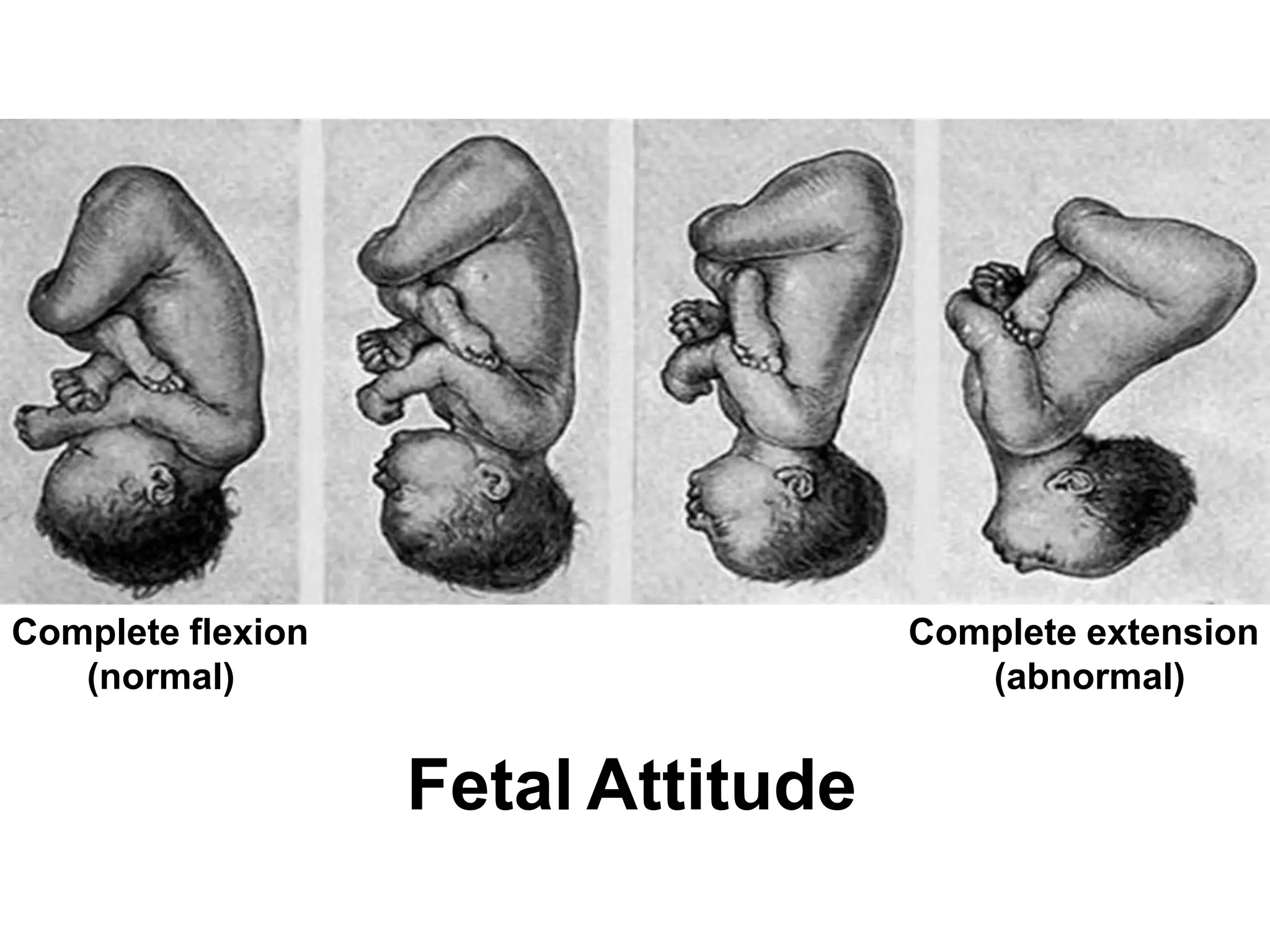 NORMAL LABOUR& Mechanism.pptx