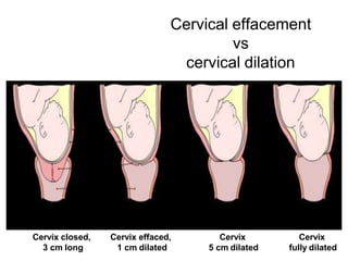 NORMAL LABOUR& Mechanism.pptx