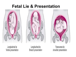 NORMAL LABOUR& Mechanism.pptx