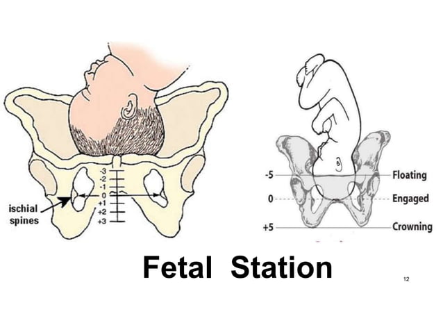 NORMAL LABOUR& Mechanism.pptx