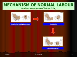 Normal labour,second stage by Dr Yin Moe | PPT