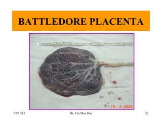 Normal labour, third stage by Dr Yin Moe | PPT