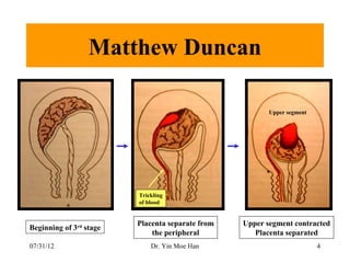Normal labour, third stage by Dr Yin Moe | PPT