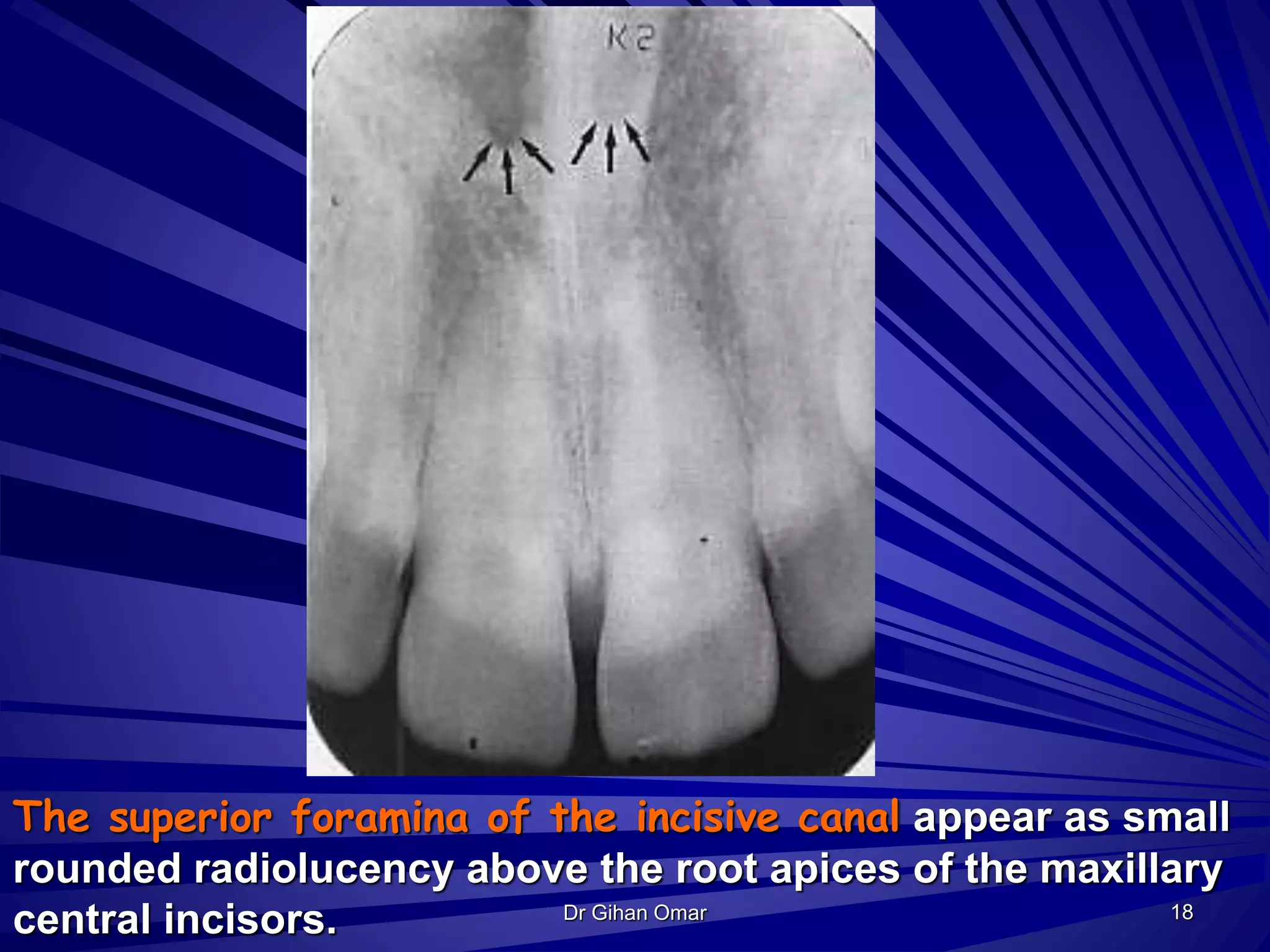 Normal radiographic landmarks | PPTX