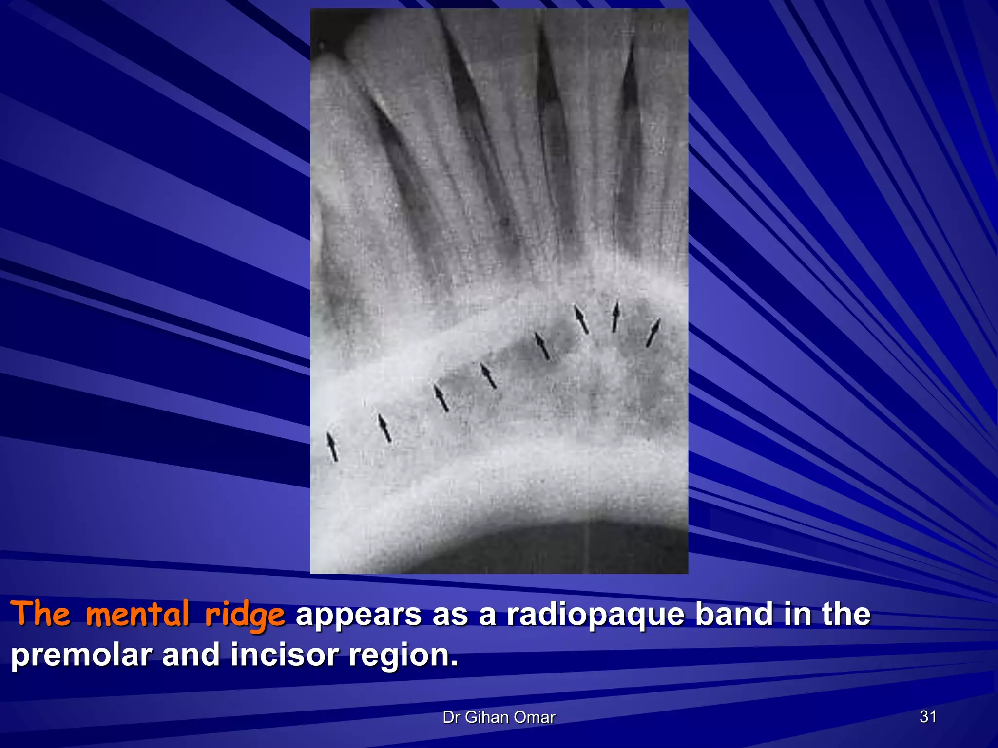 Normal radiographic landmarks | PPTX