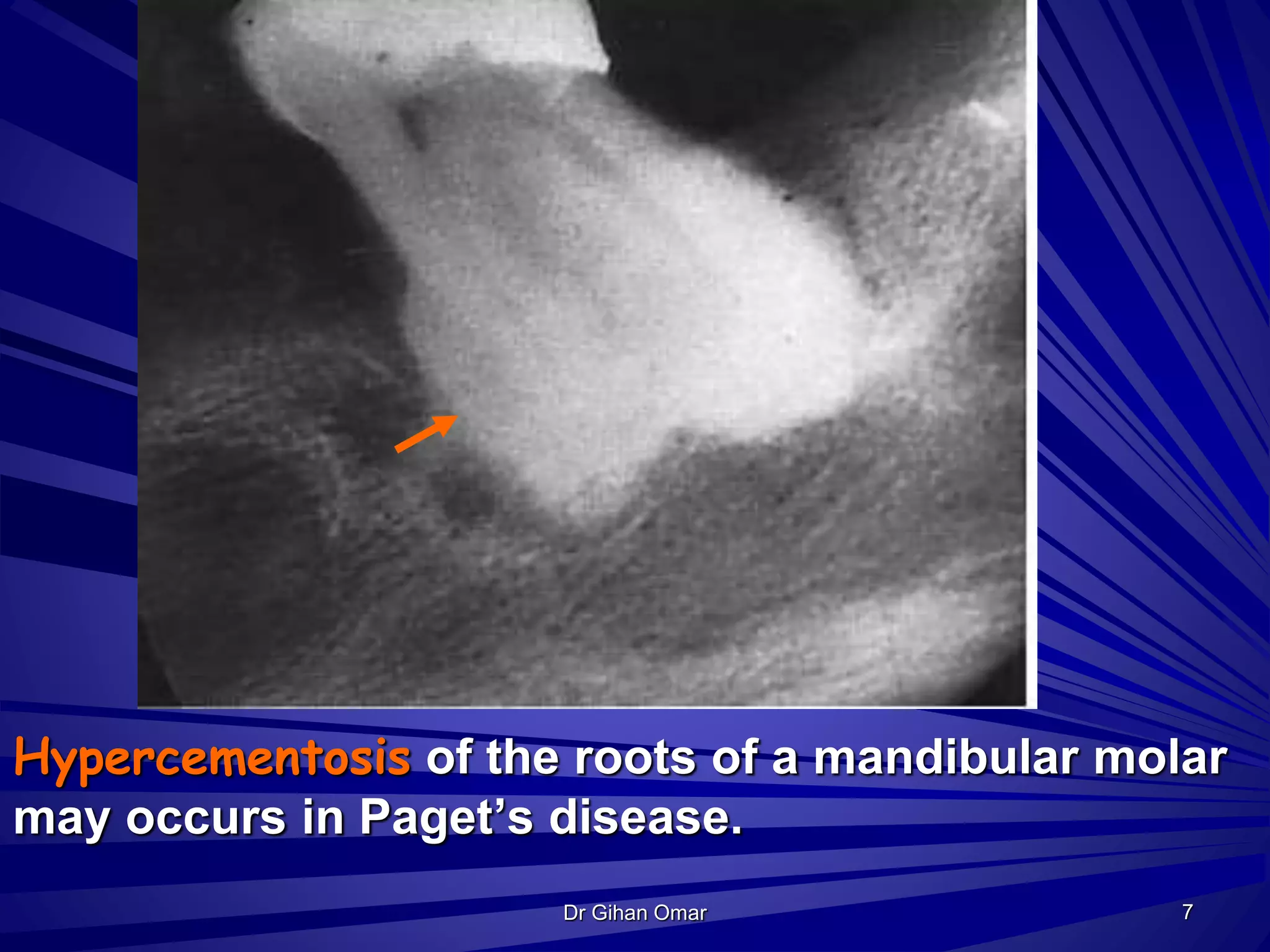 Normal radiographic landmarks | PPTX