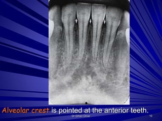 Alveolar Crest Radiograph