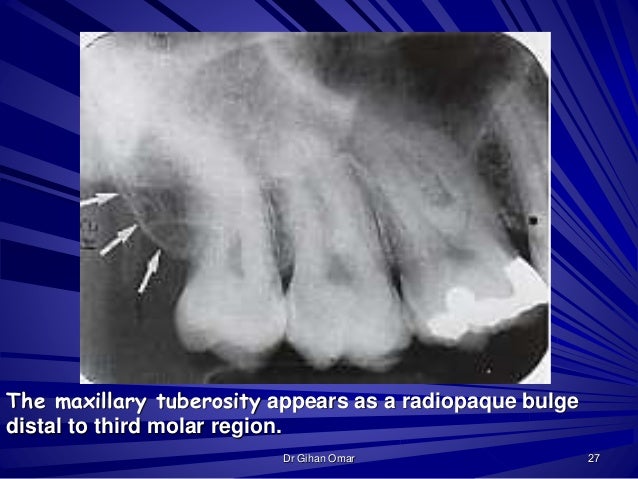 Normal radiographic landmarks