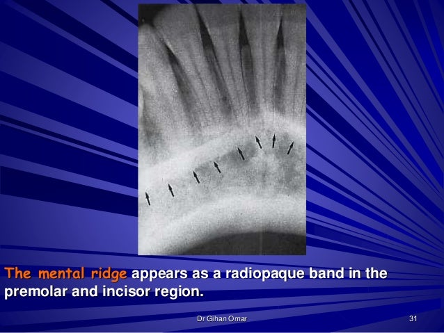 Normal radiographic landmarks