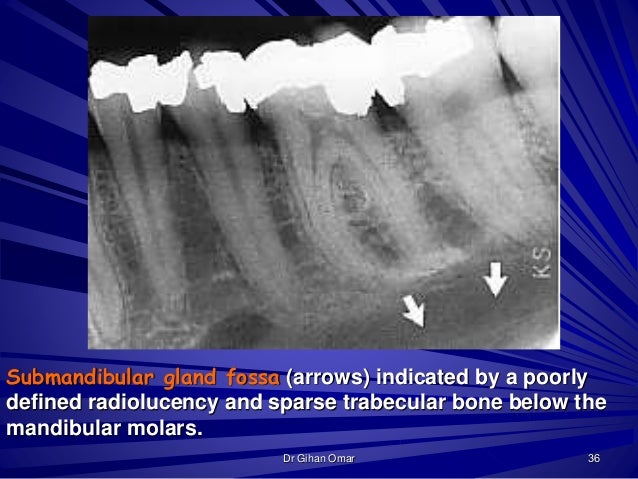 Normal radiographic landmarks