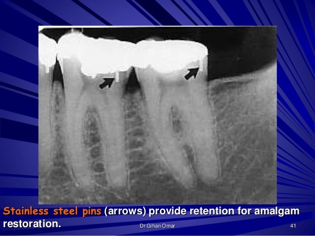 Normal radiographic landmarks