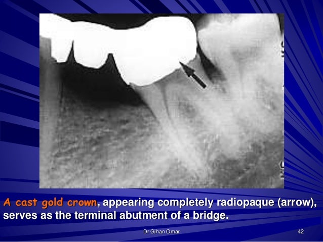 Normal radiographic landmarks