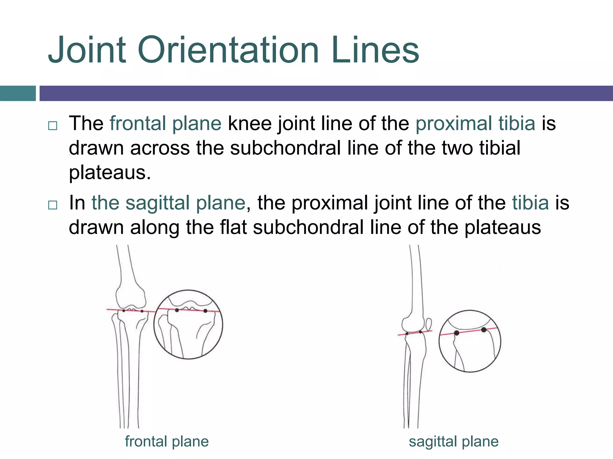 Normal limb alignment | PPTX