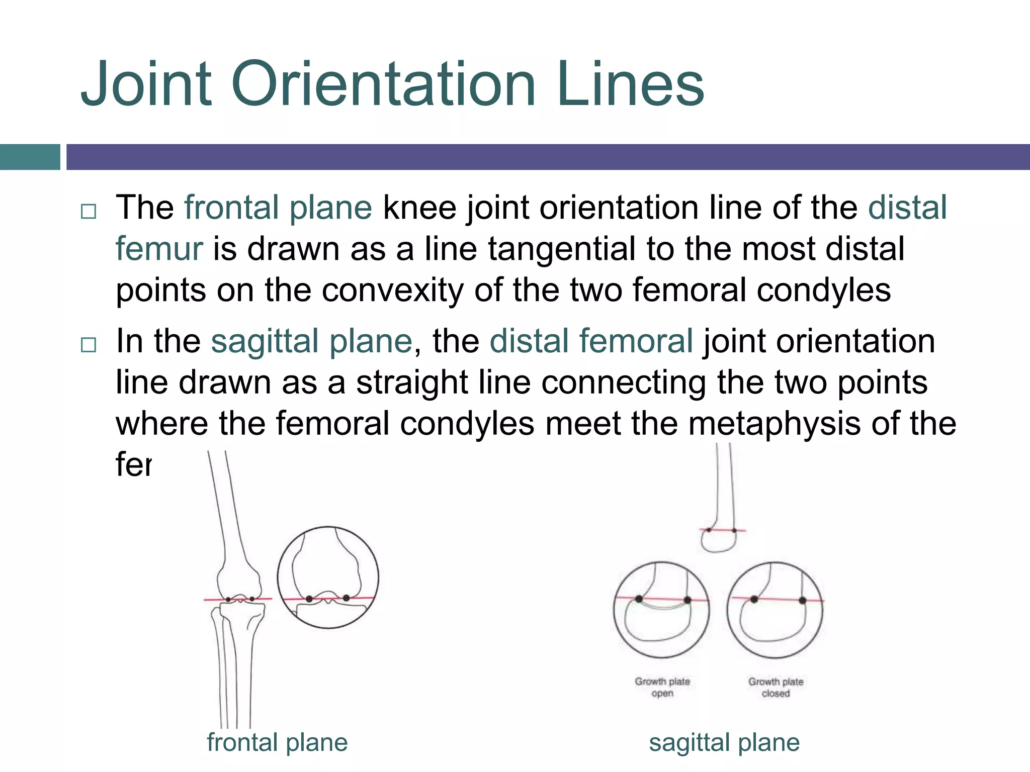 Normal limb alignment | PPTX