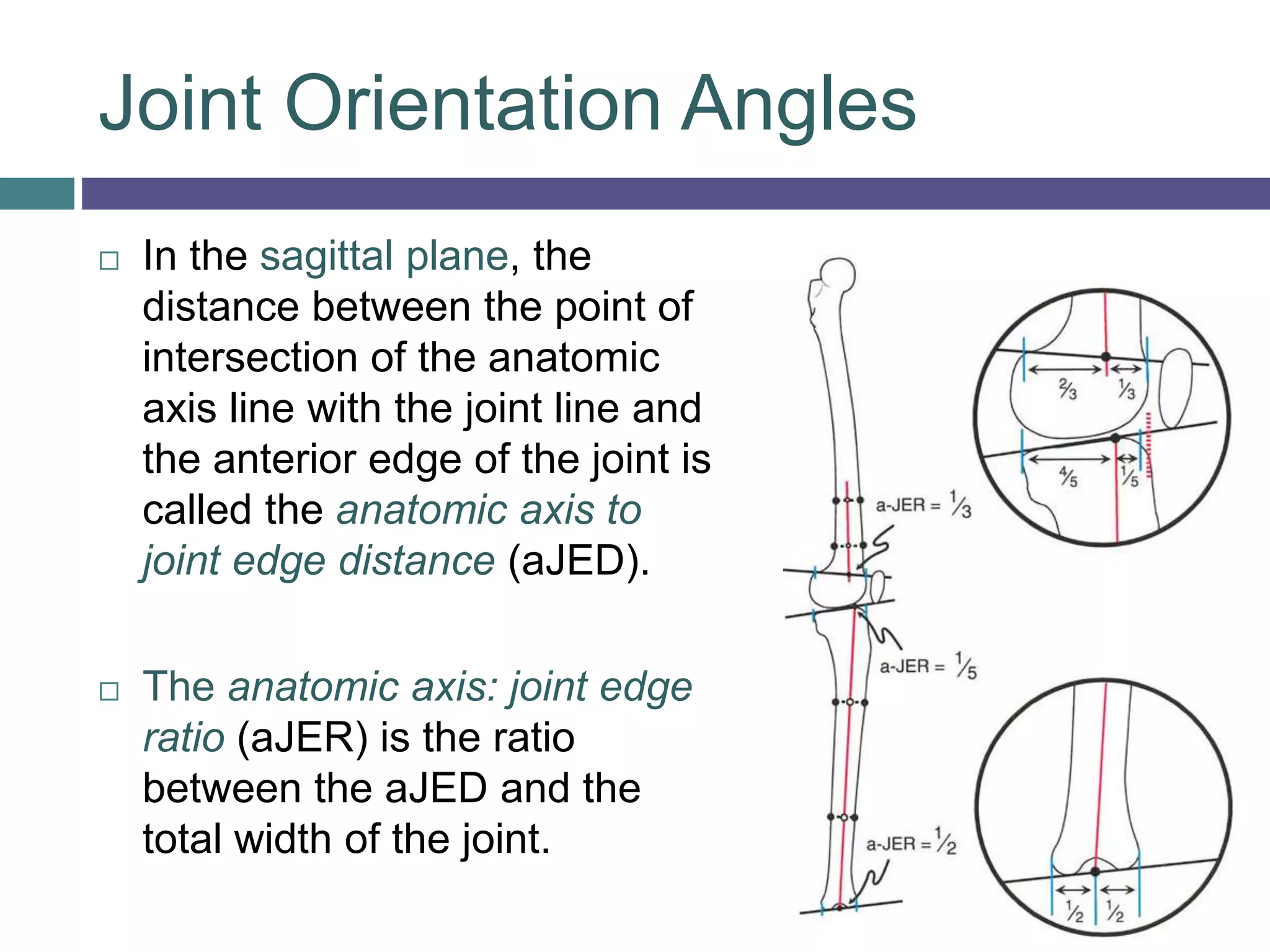 Normal limb alignment | PPTX