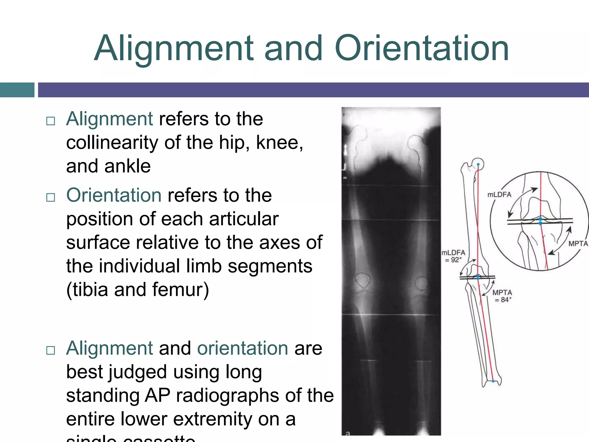 Normal limb alignment | PPTX