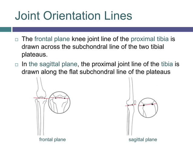 Normal limb alignment | PPTX | Death, Injury, or Military Conflict ...