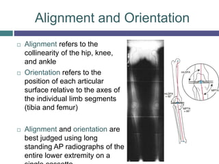 Normal limb alignment | PPTX