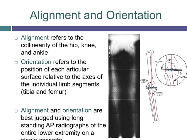 Normal limb alignment | PPTX | Death, Injury, or Military Conflict ...