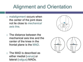 Normal limb alignment | PPTX