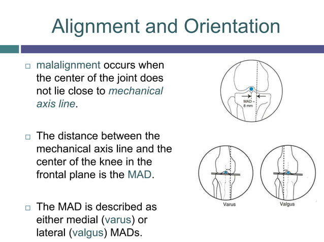 Normal limb alignment | PPTX | Death, Injury, or Military Conflict ...