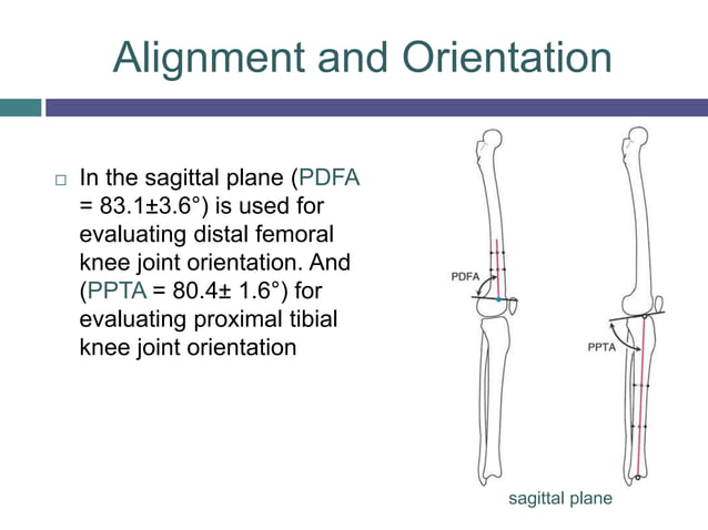 Normal limb alignment | PPTX | Death, Injury, or Military Conflict | Sensitive Topics