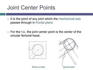 Normal limb alignment | PPTX
