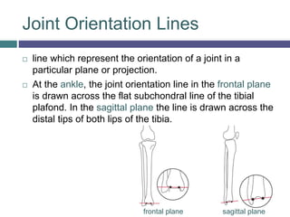 Normal limb alignment | PPTX