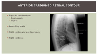 Normal mediastinum radiograph | PPTX