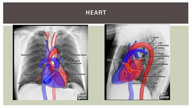 Normal mediastinum radiograph | PPT