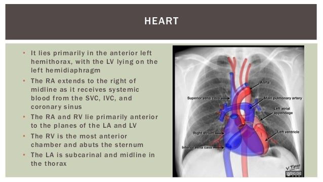 Normal mediastinum radiograph