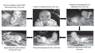 Normal motor development - infants | PPTX