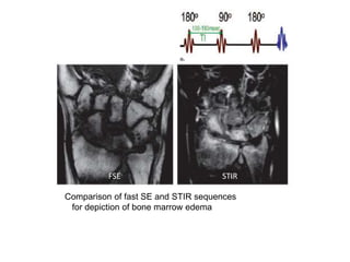 Normal mri brain | PPTX