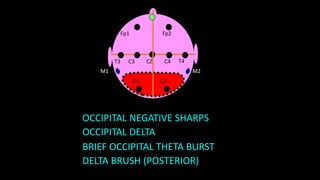 Normal Neonatal EEG | PPTX