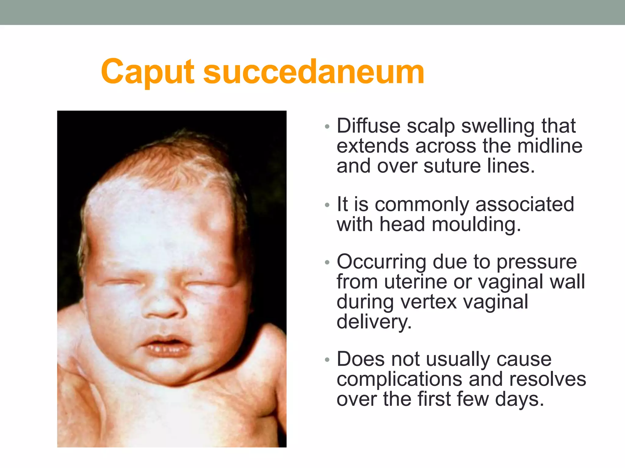 Normal Newborn & Common Neonatal problems.ppt