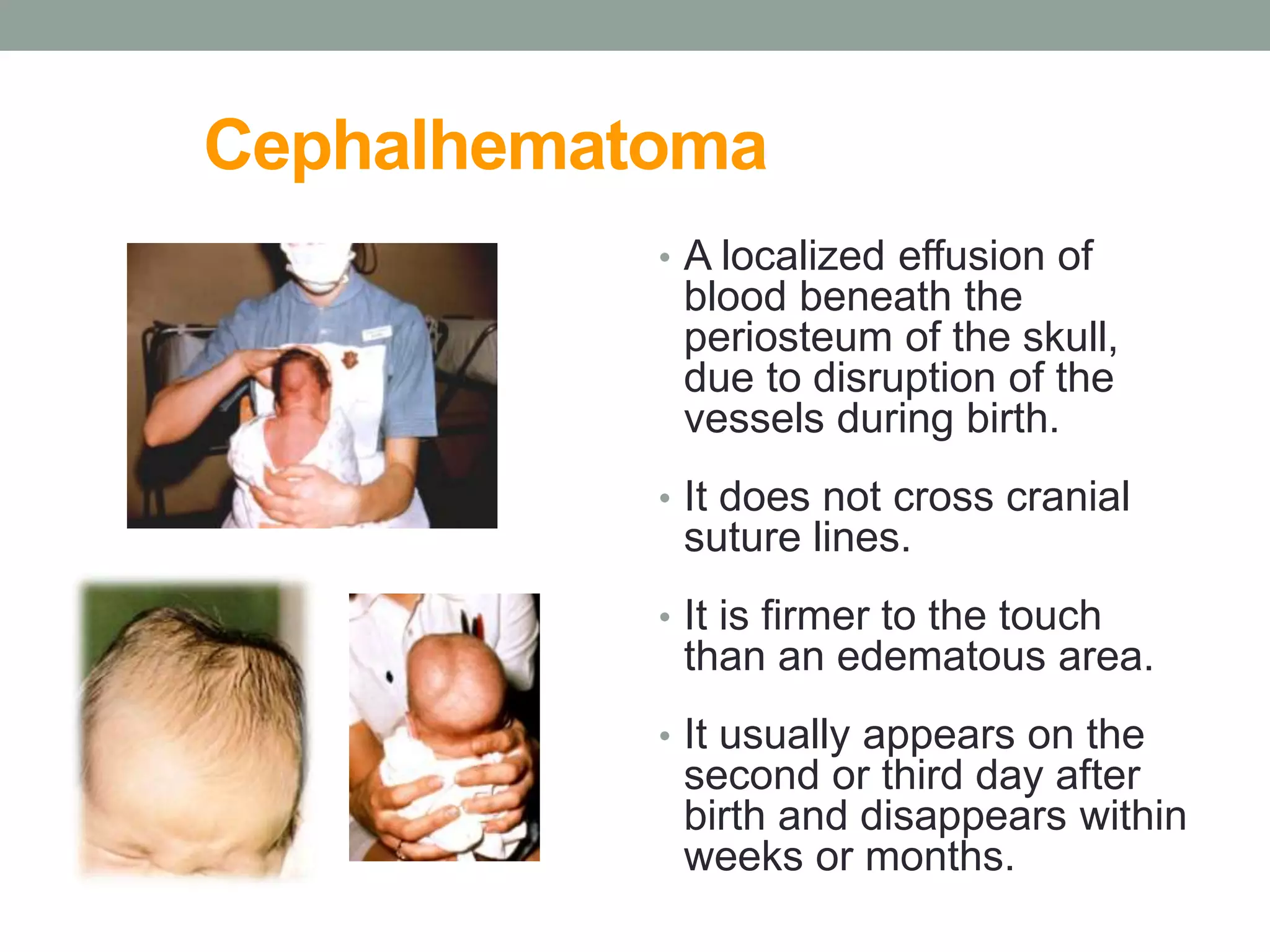Normal Newborn & Common Neonatal problems.ppt